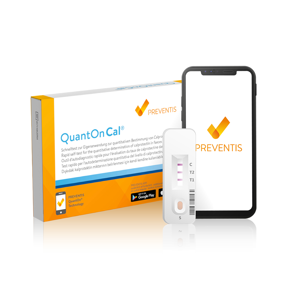 Patient-oriented diagnostics anytime & anywhere – Preventis